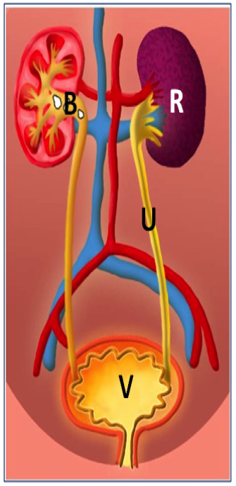 Groupe Urologie Saint-Augustin : Urétéroscopie